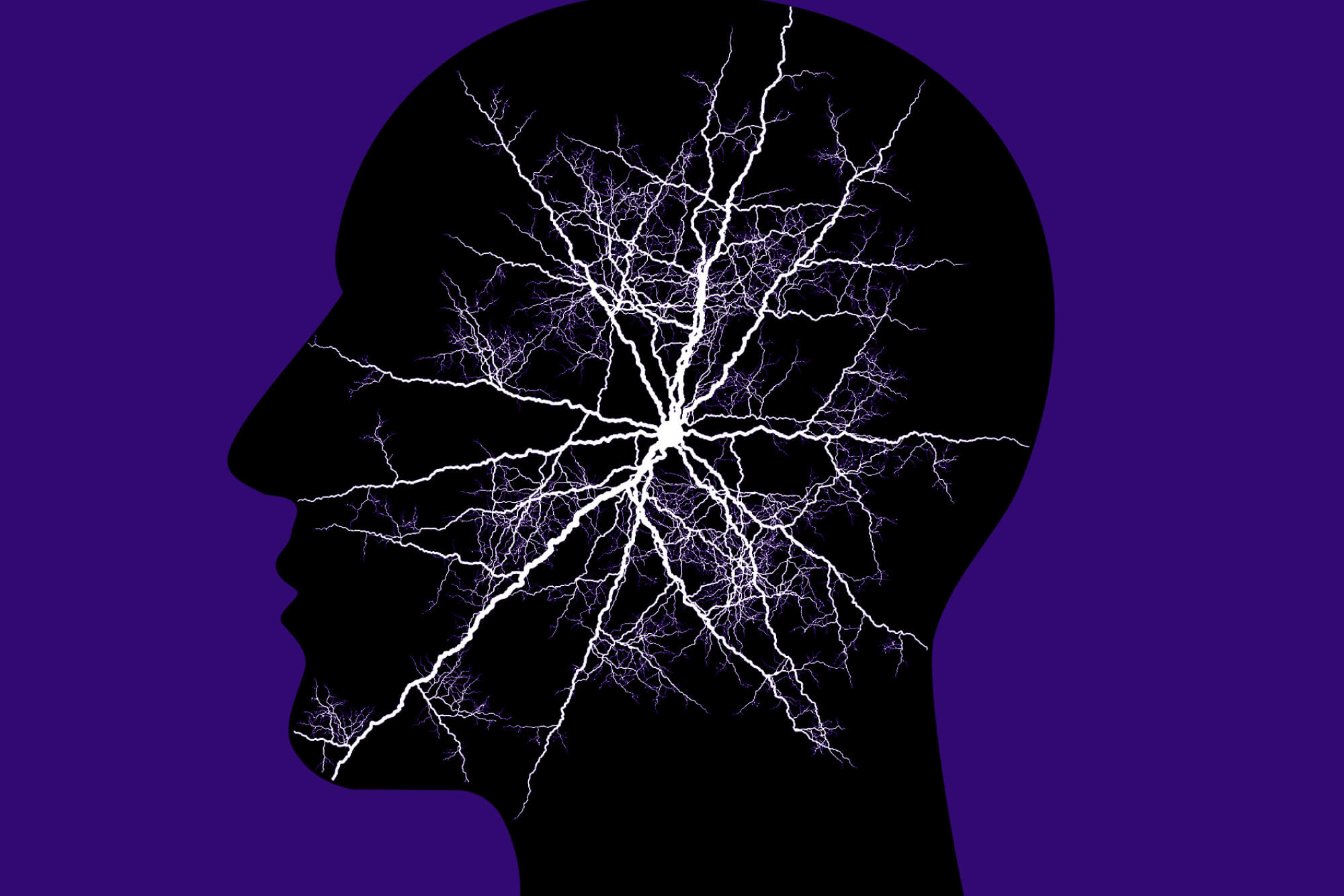 Ictus: sintomi, conseguenze e riabilitazione - Emianopsia