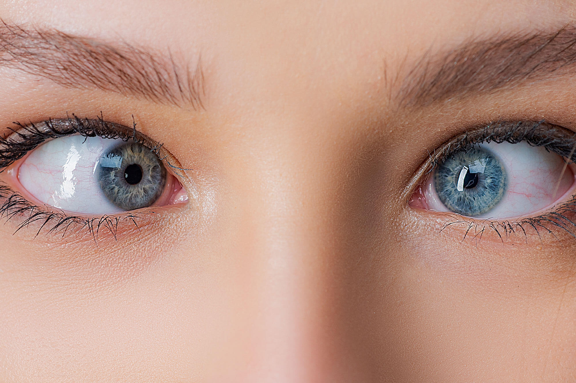 Squint: types, symptoms and treatments - Emianopsia