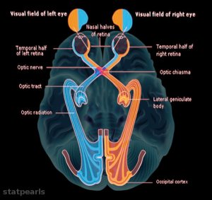 Hemianopsia and diseases of the optic chiasma - Emianopsia
