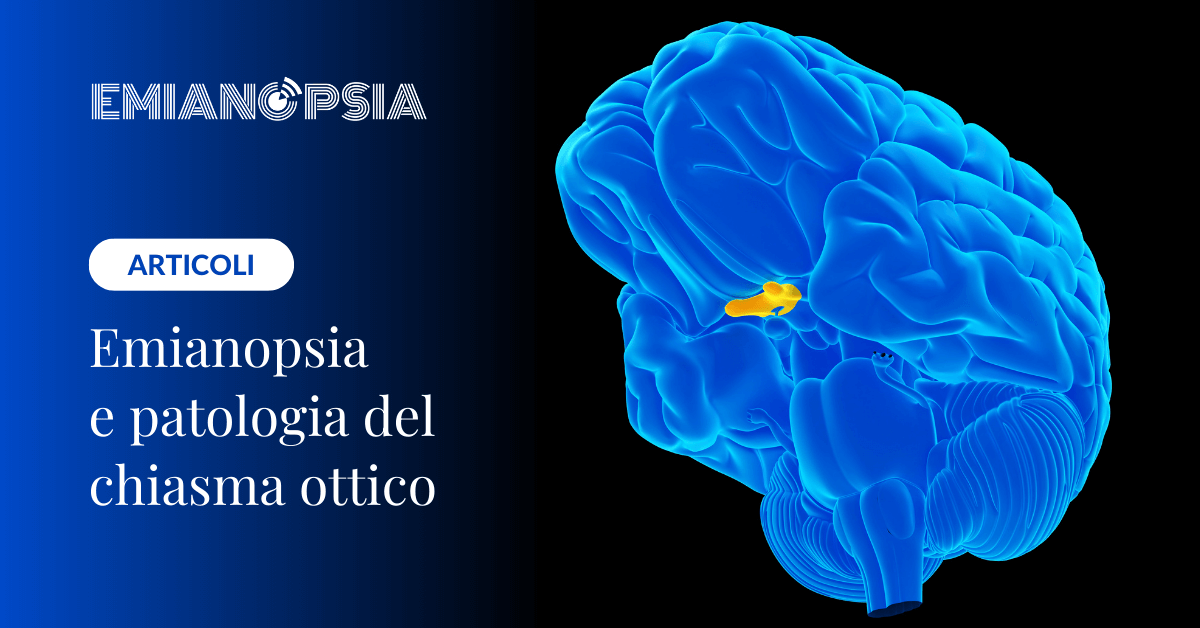 Hemianopsia and diseases of the optic chiasma - Emianopsia