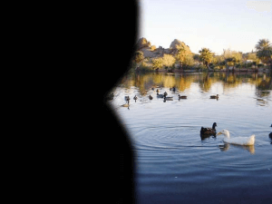 Types of Hemianopias - Emianopsia