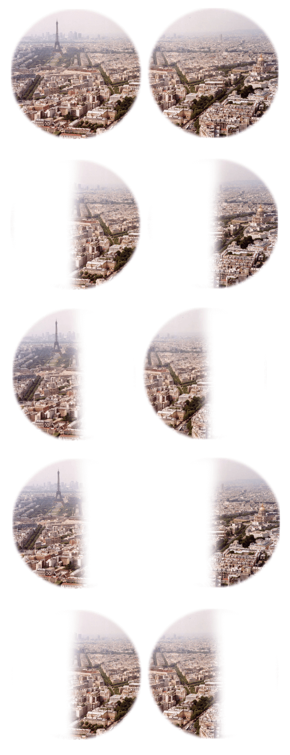 Types of Hemianopias - Emianopsia