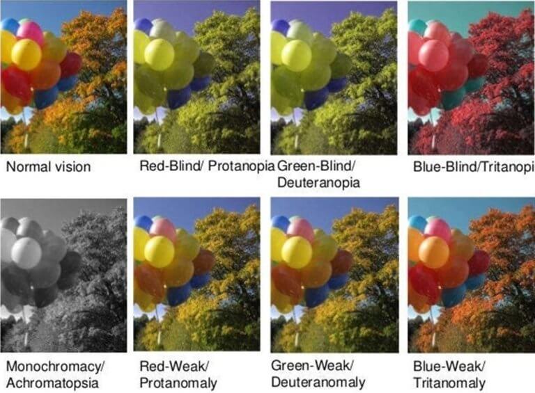 Color perception and diagnostic tests - Emianopsia