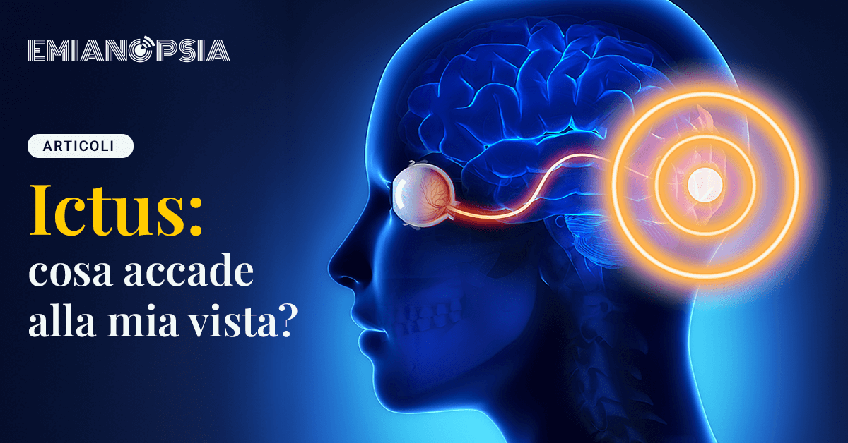 Stroke: what happens to eyesight? - Emianopsia
