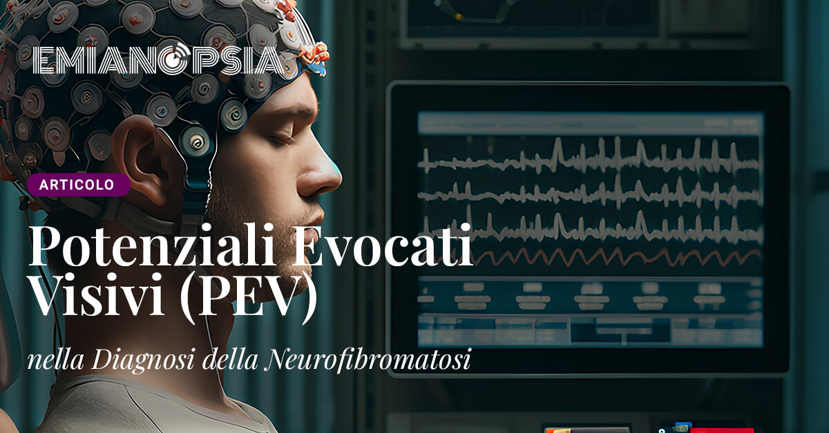 Potenziali Evocati Visivi (PEV) nella diagnosi della Neurofibromatosi ...